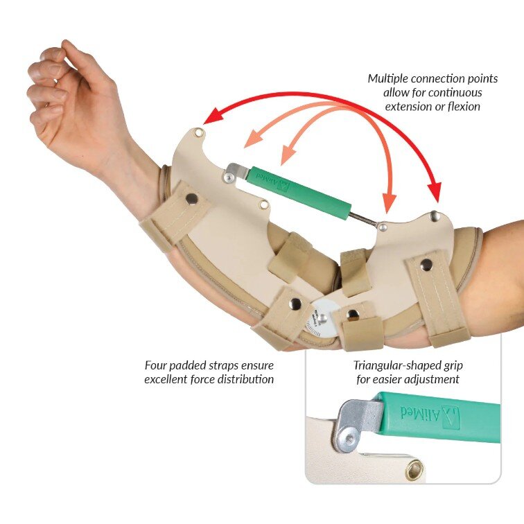 Turnbuckle Elbow Orthosis | C | 52396/NA/NA/C